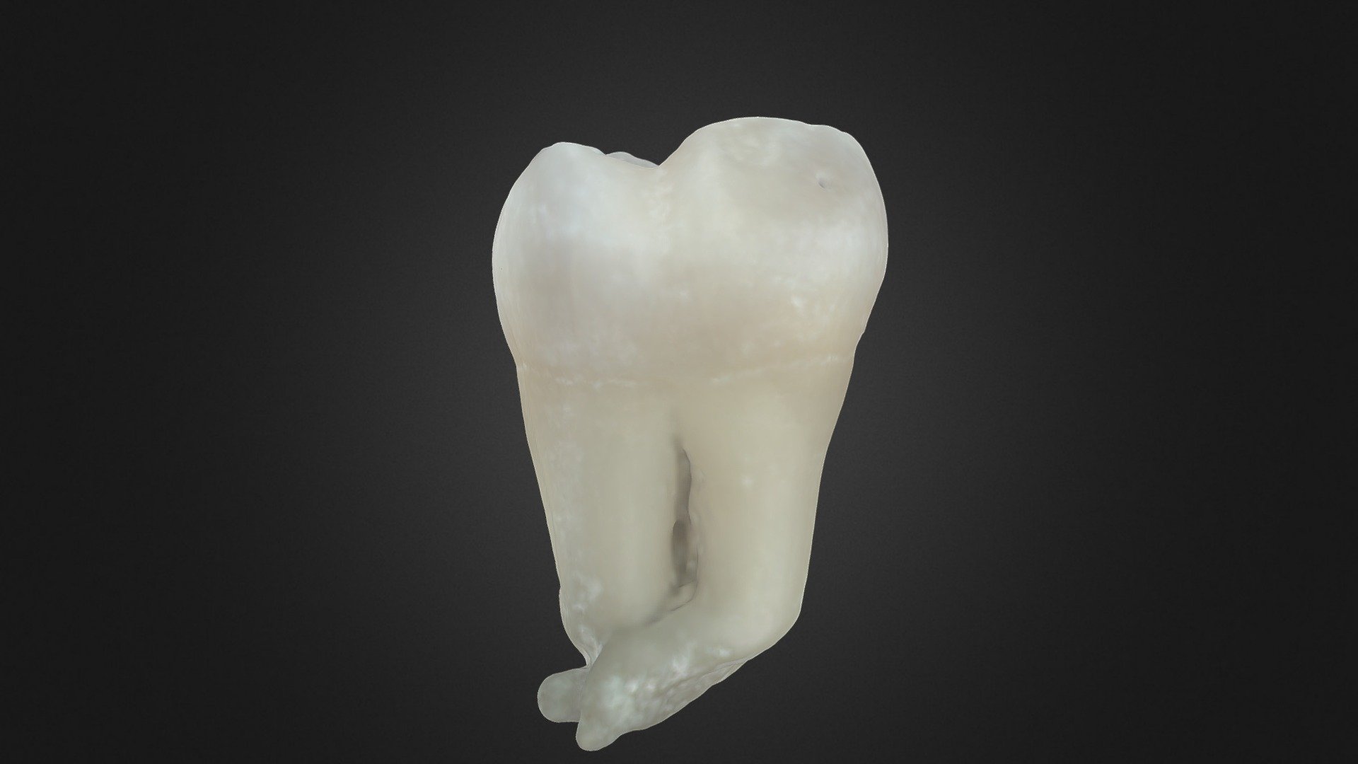 Dente 48 - Lower Right Third Molar (ID 48a) - Download Free 3D model by ...