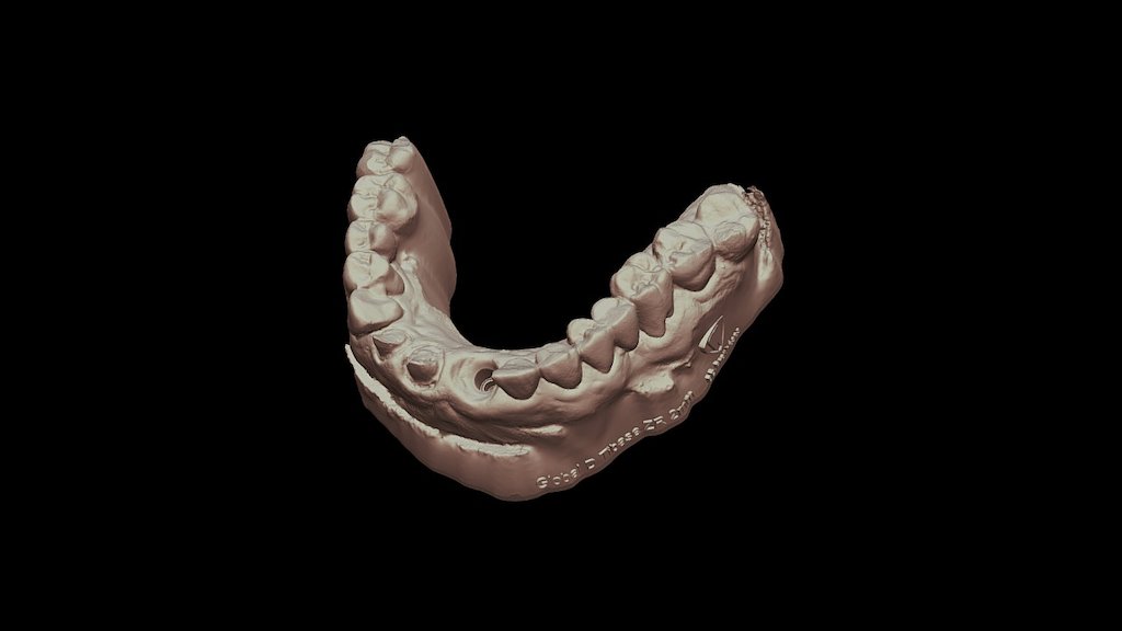 Global D - 3D model by bdprotheses [6b6b9aa] - Sketchfab