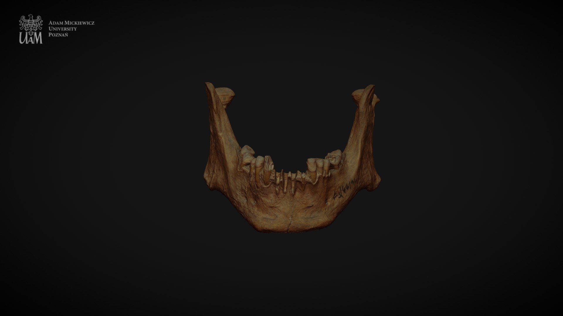 Achondroplastic dwarf - mandible - 3D model by AMU Human Evolutionary ...