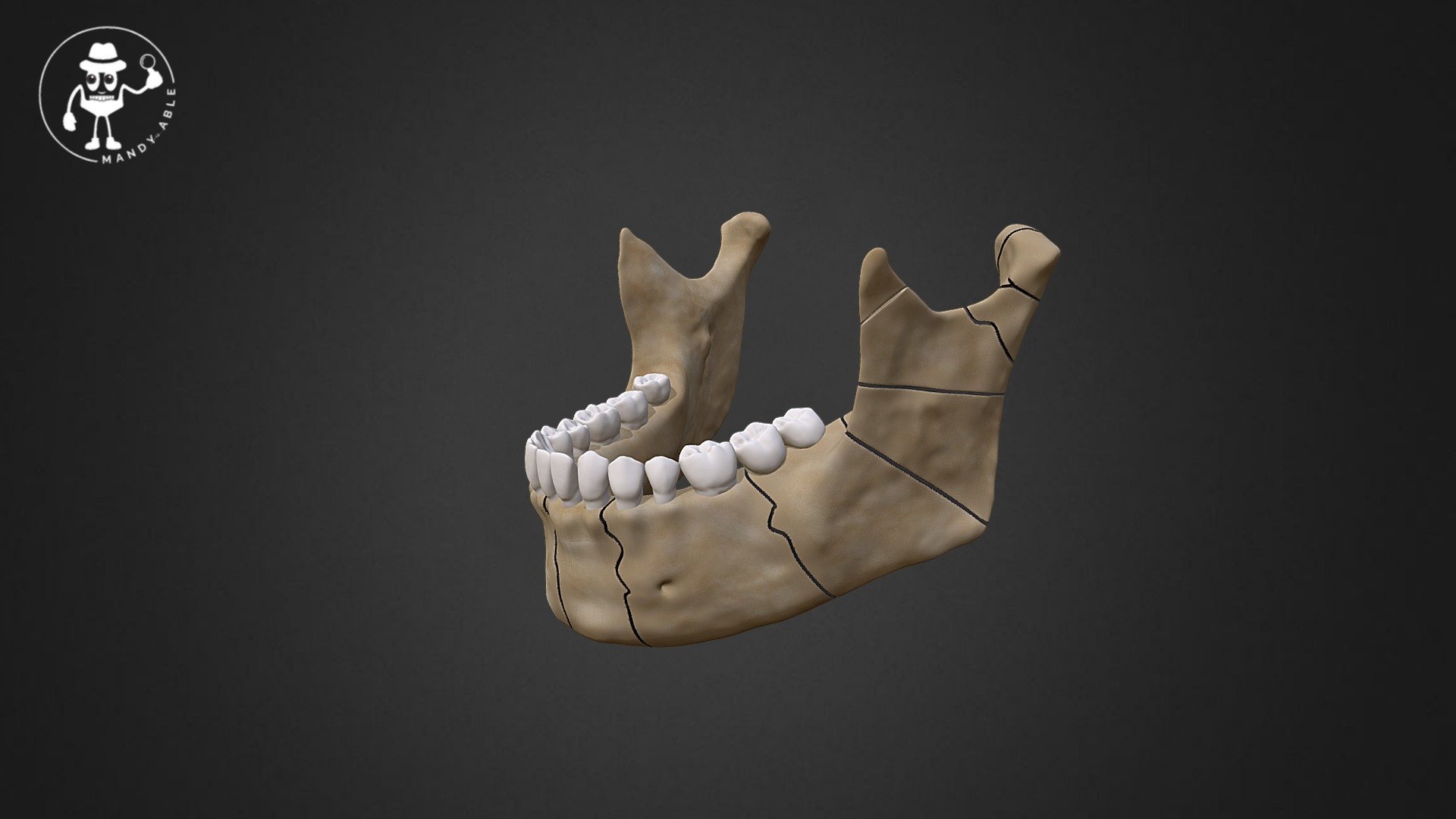 Fractures based on anatomical location - 3D model by Doha Abualhija ...