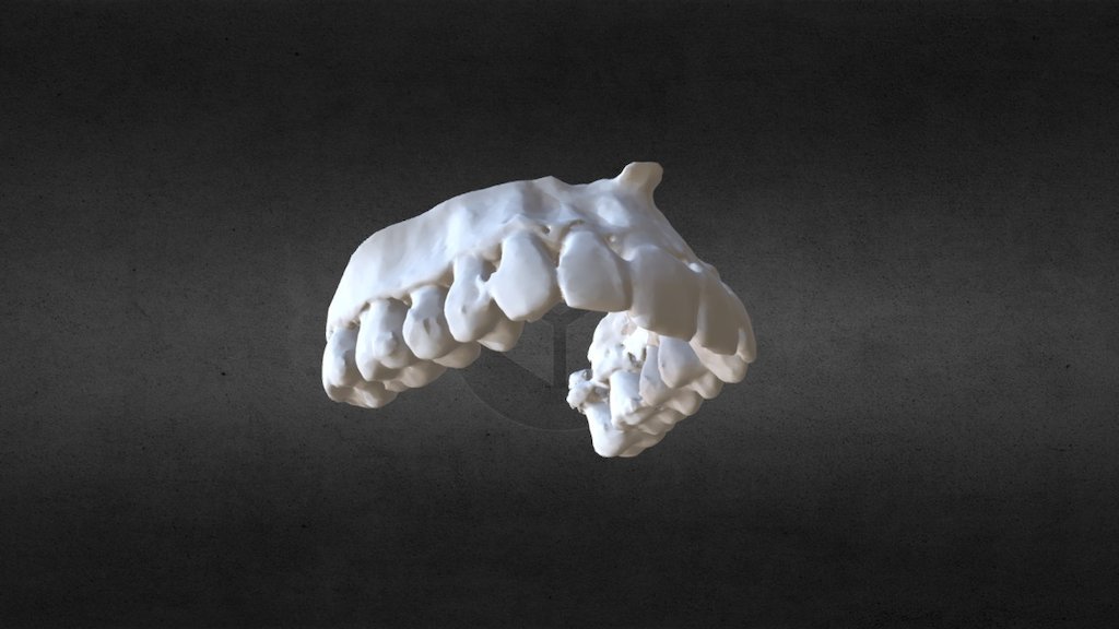 Upper Jaw - 3D model by Mission 3D (@mission3d) [6ccd37a] - Sketchfab