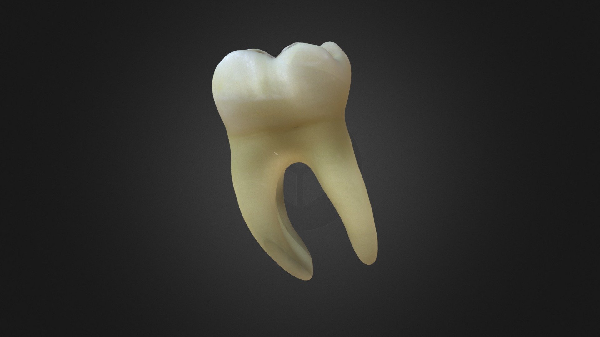 Lower 1st Molar - 3D model by SDEO [6cd087e] - Sketchfab