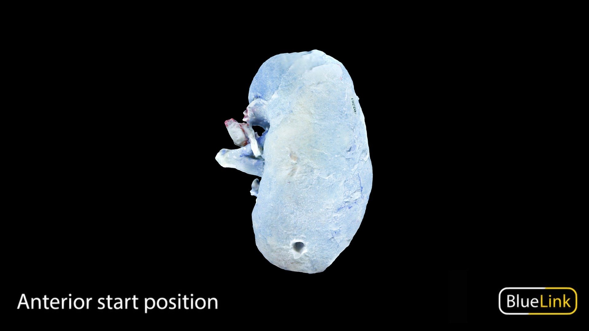 Bisected Blue Colored Kidney - Left - Download Free 3D model by ...