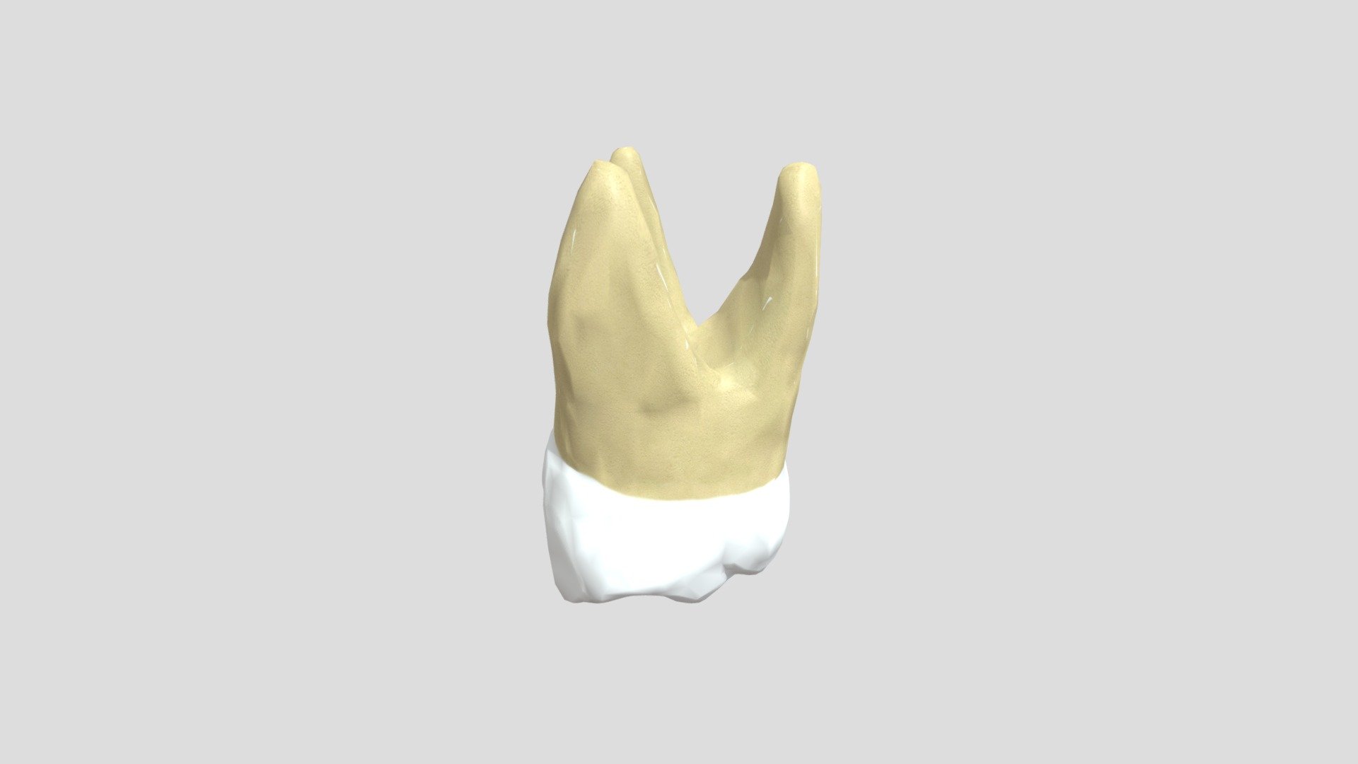 ASDOH MAXILLARY FIRST MOLAR - 3D model by Ahmed Mahrous (@drahedmahrous ...