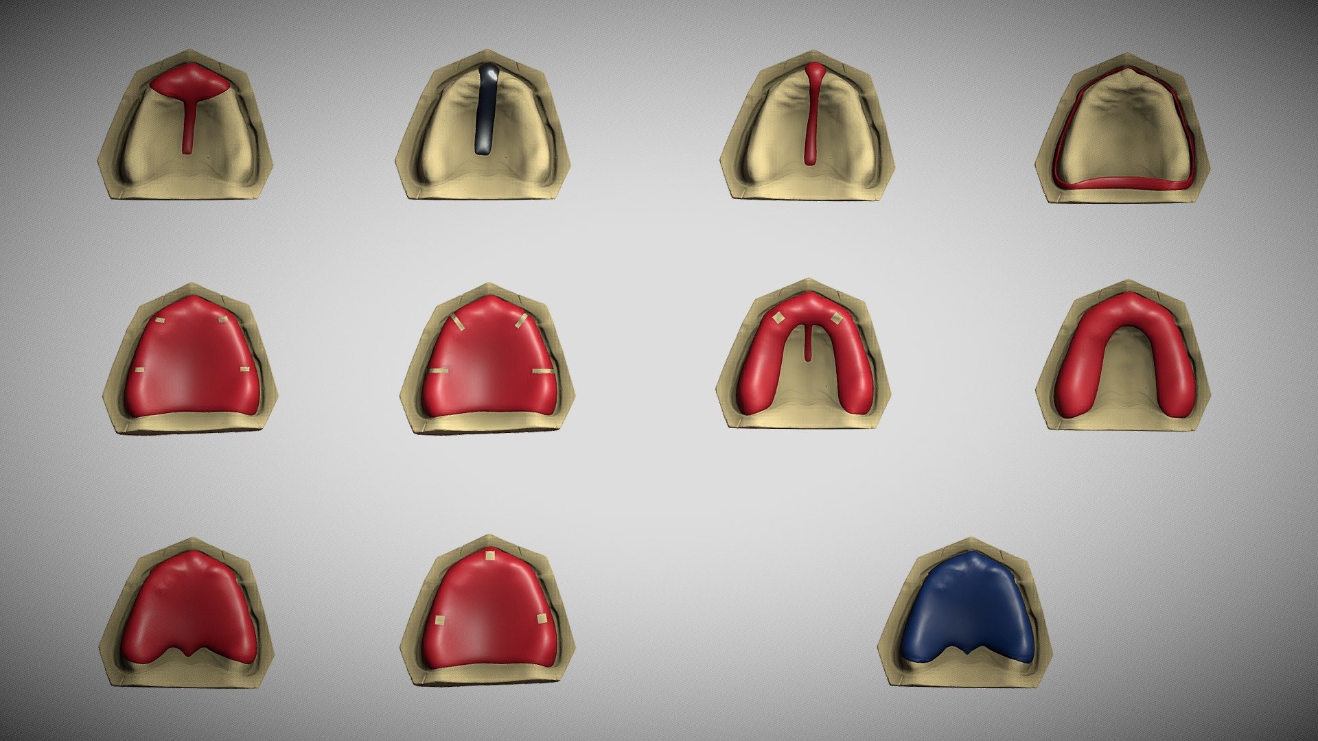 Spacer Designs for Complete Dentures Part 1 - 3D model by Muhammad ...