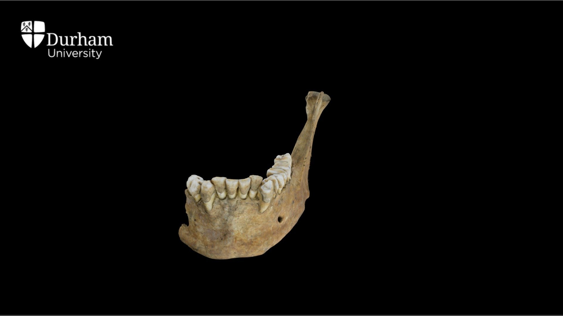 Male Mandible with annotations - 3D model by Durham Archaeology ...