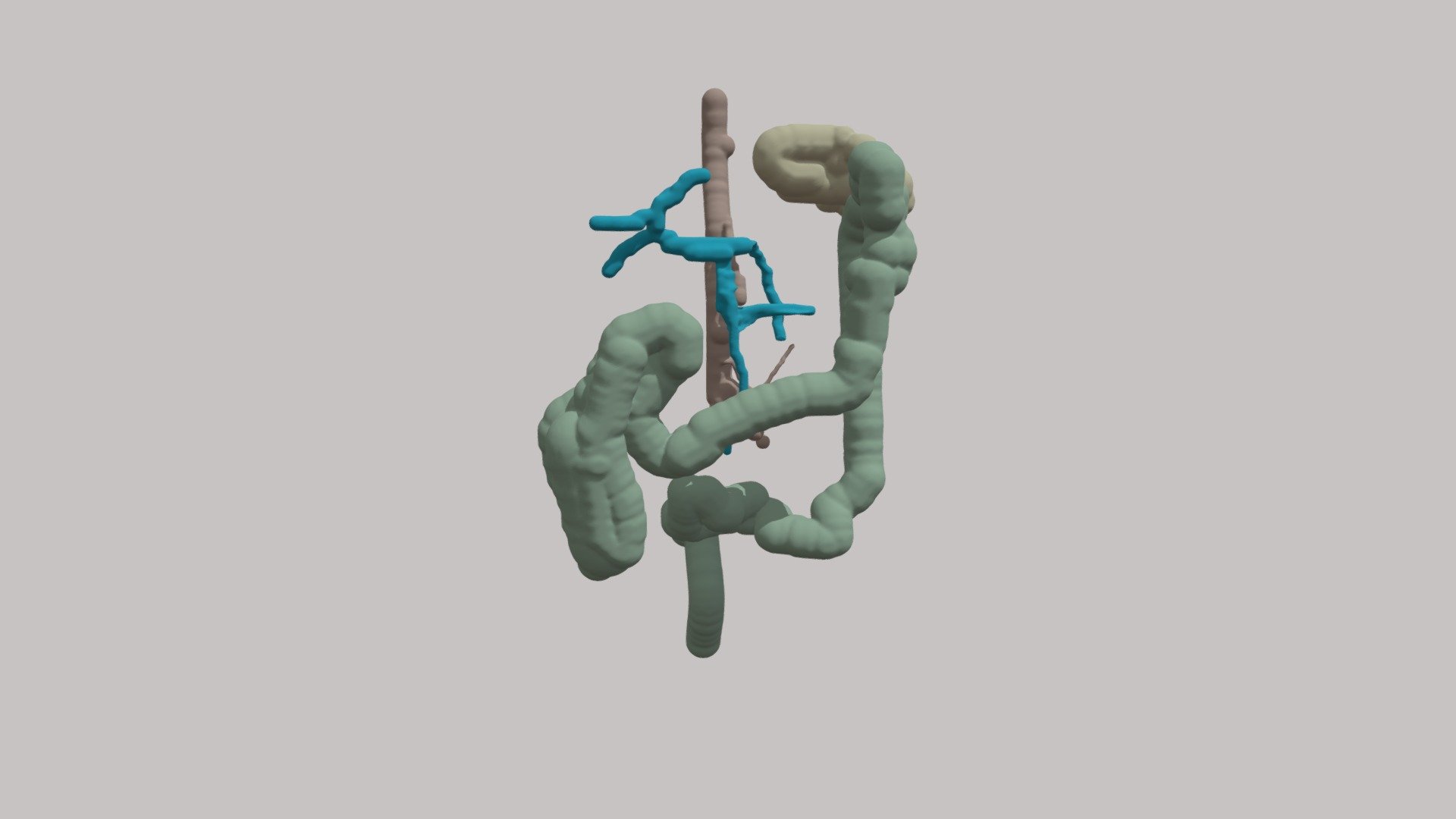 Segmentation - 3D model by medicinskbild [6def7cb] - Sketchfab