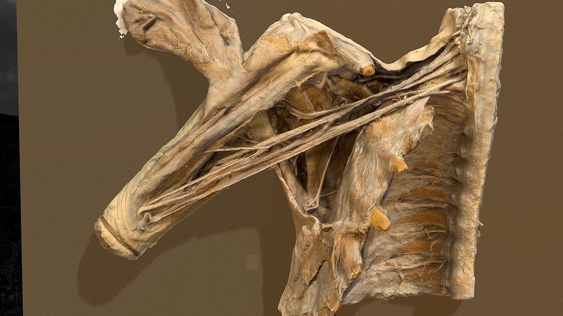 Creux Axillaire - 3D model by Prof. Serge VAN SINT JAN - Univ. Libre ...
