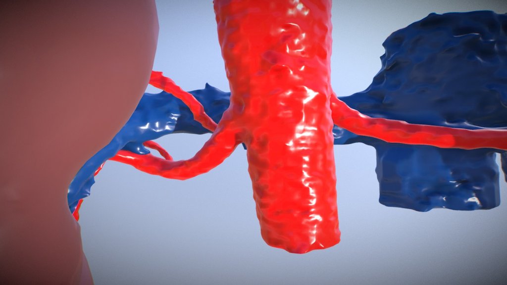 Kidney_Angio-CT - 3D model by HOLOCARE [6dfb940] - Sketchfab