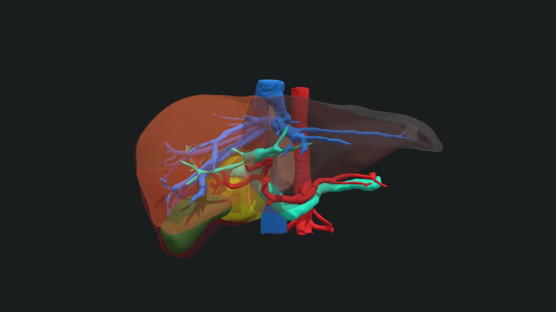 Liver tumor - 3D model by thorac.topsurgery [6dfbef5] - Sketchfab