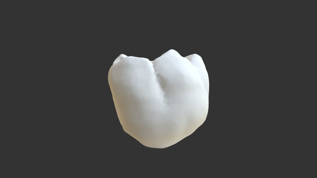 Lower Molar - 3D model by Arum3D solutions (@hoildental) [6e8d288 ...