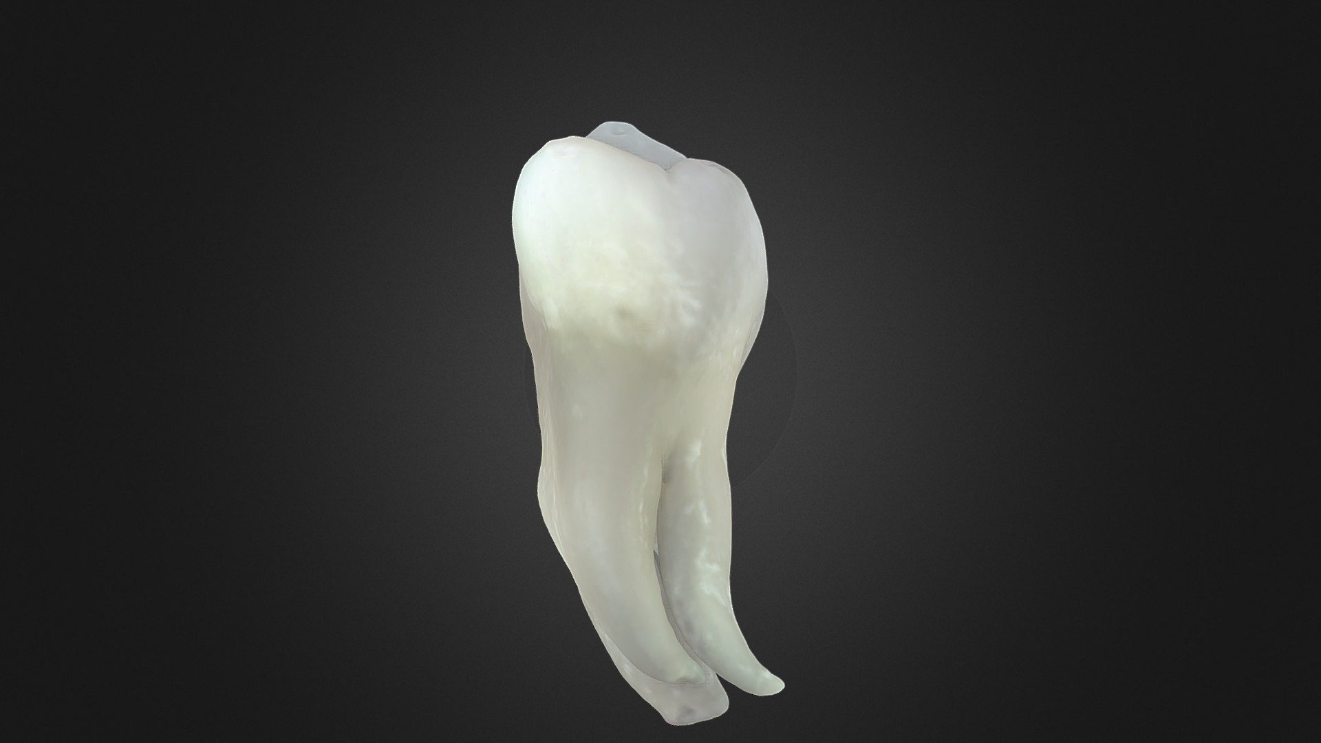 Dente 17 - Upper Right Second Molar (ID 17b) - Download Free 3D model ...