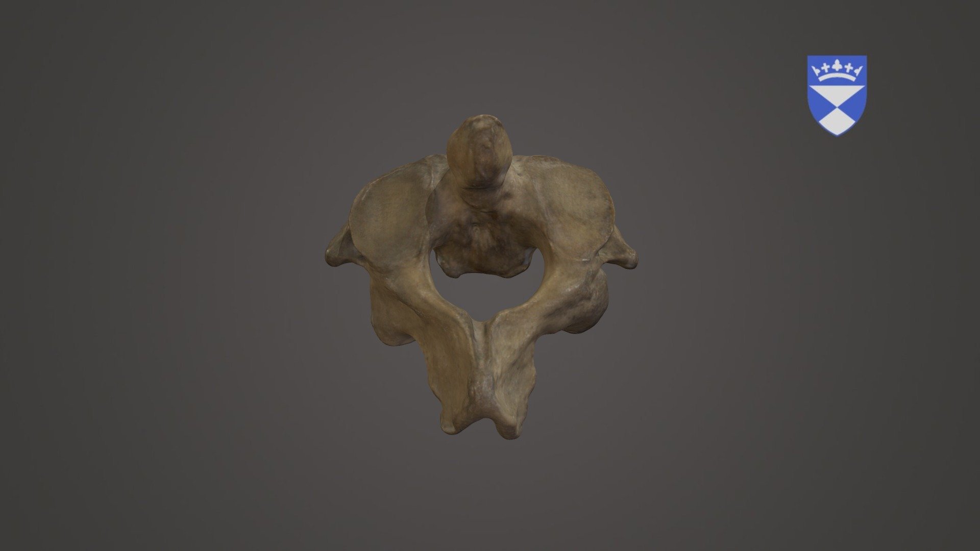 Axis - 3D model by University of Dundee, CAHID (@anatomy_dundee ...