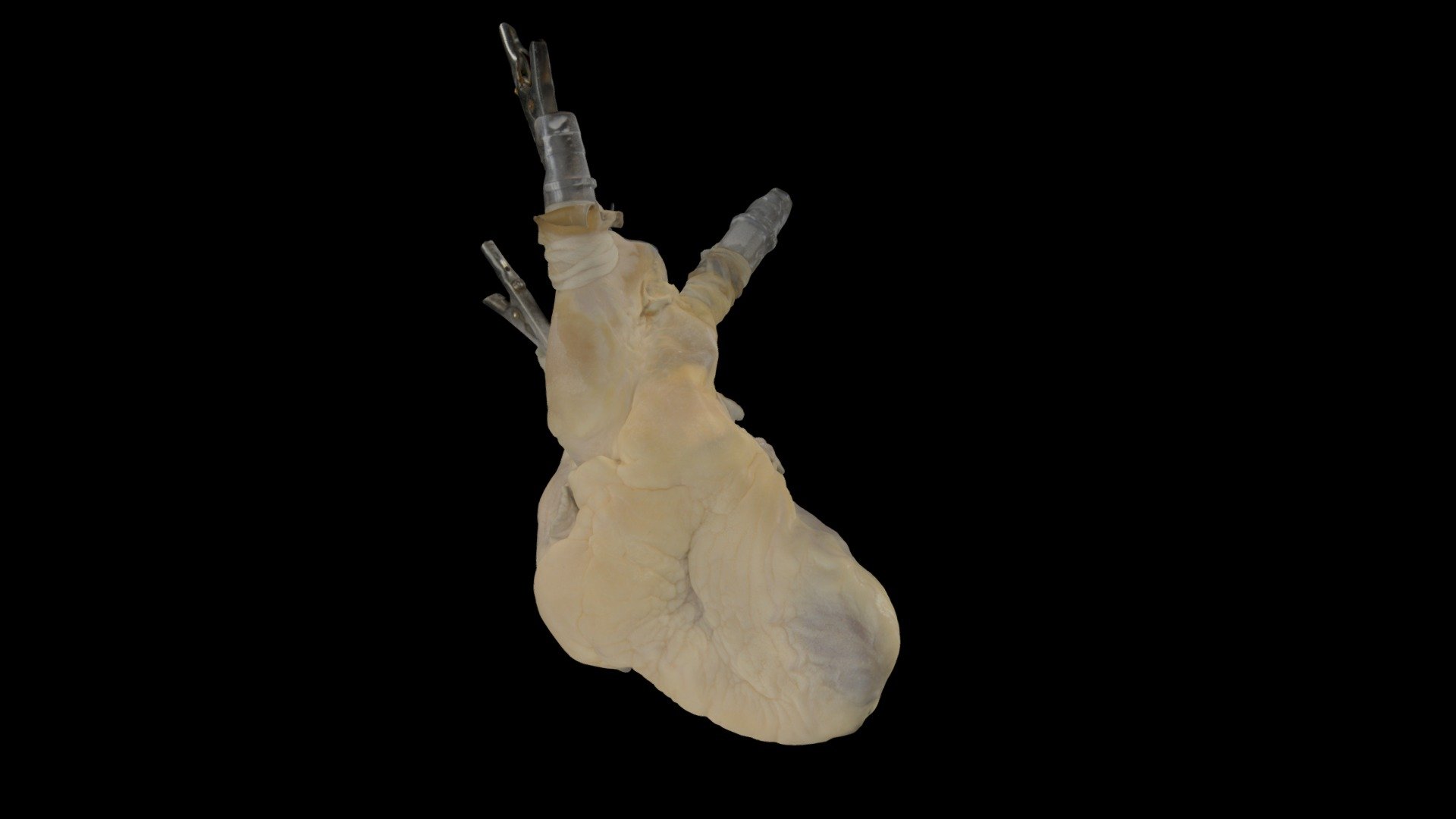 Human Heart Donation #0575 - Download Free 3D model by VisibleHeartLabs ...