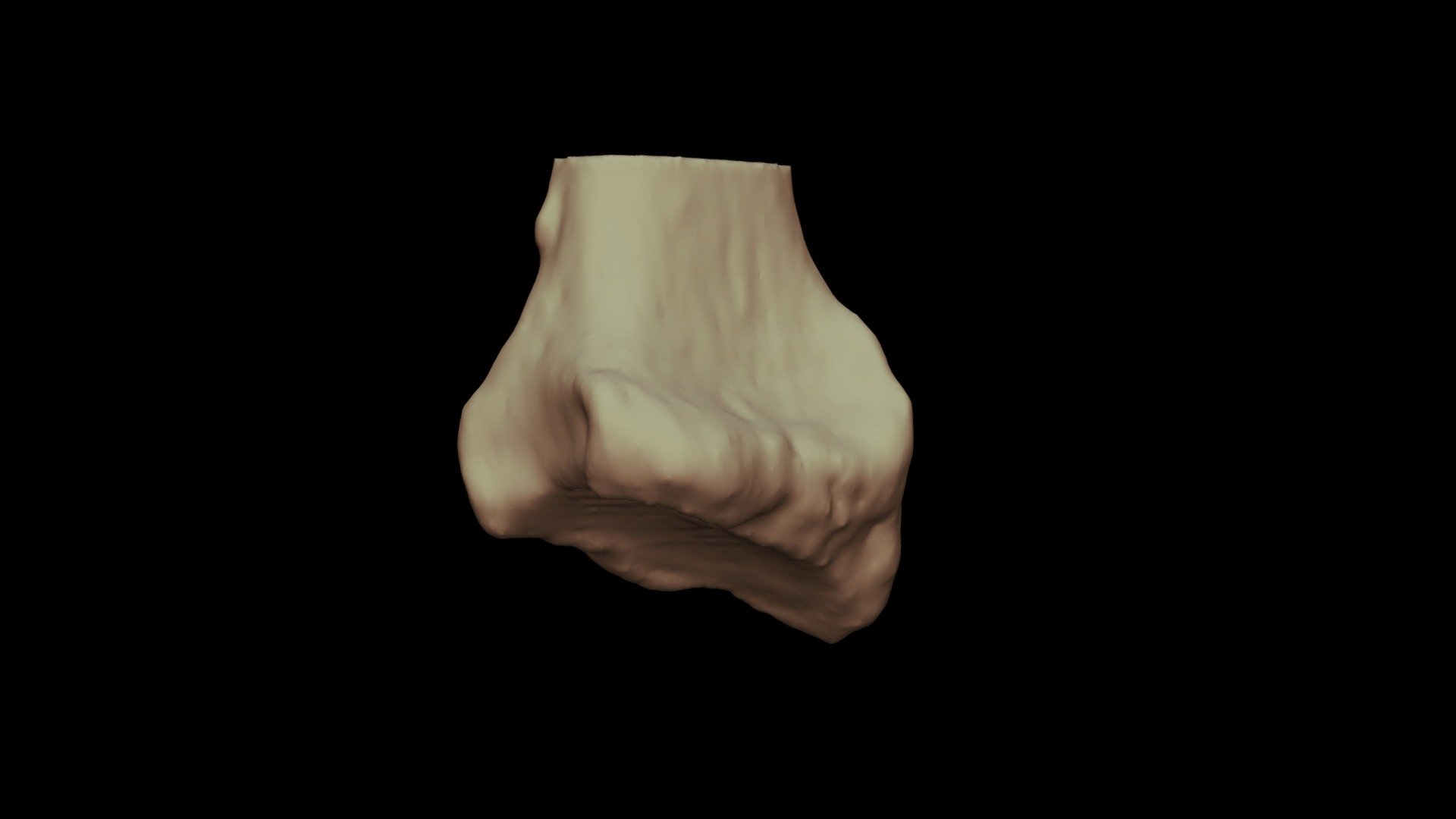 Radius - Epiphyse distale - 3D model by Prof. Serge VAN SINT JAN - Univ ...