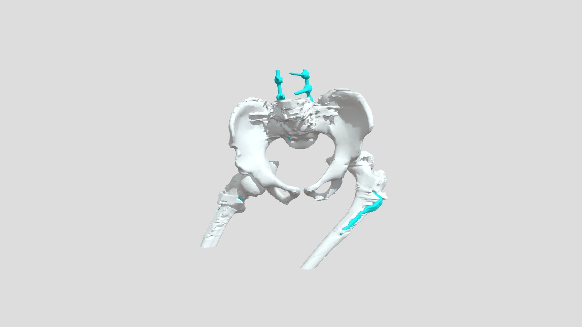 Pelvis + Hip (S0342) - 3D model by NCH Advanced Projects Laboratory ...