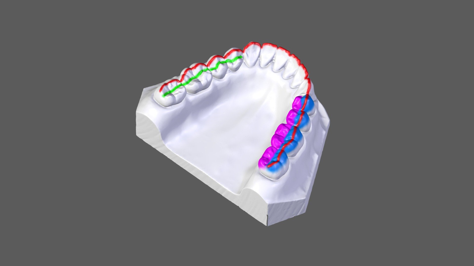 Arcada Inferior - Cúspides - Download Free 3D model by Ricardo Armini ...