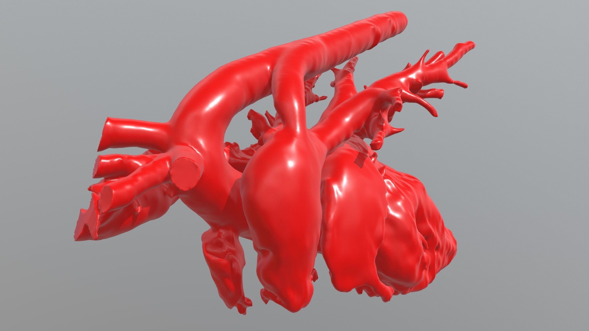 Canine Patent Ductus Arteriosus - Download Free 3D model by Pixelbeaker ...