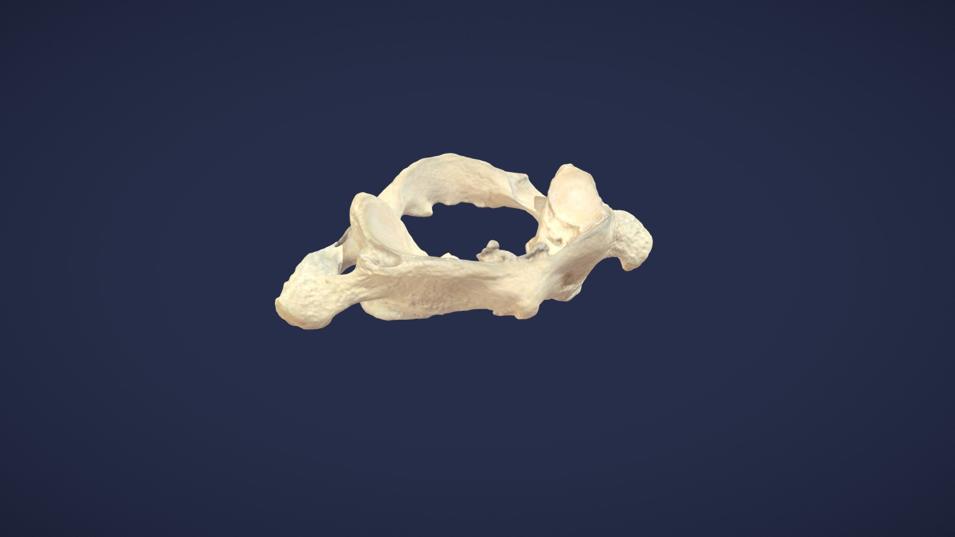 Atlas (C1) - 1st cervical vertebra - 3D model by Institute of Anatomy ...