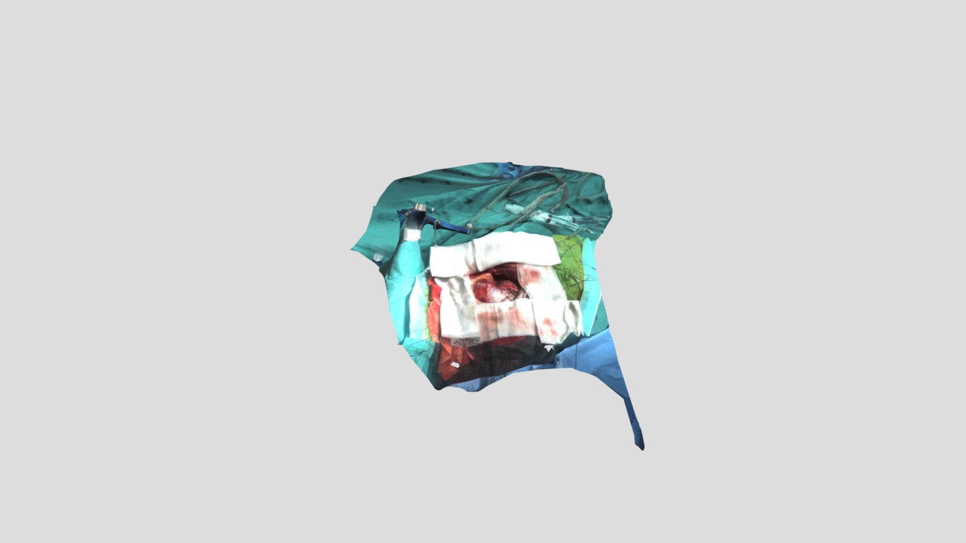 Pterional approach craniotomy - 3D model by Istanbul-Microneurosurgery ...