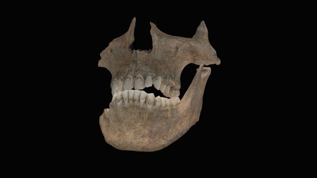 Scottish soldiers skeleton (SK 21) - 3D model by Durham University ...