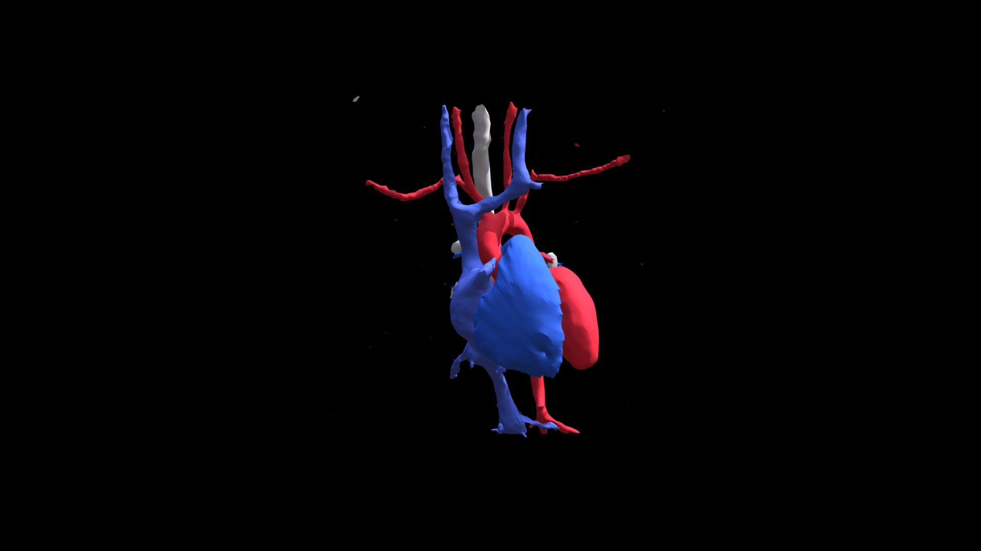 Levocardia - normal heart infant - 3D model by William S. Peters MD ...