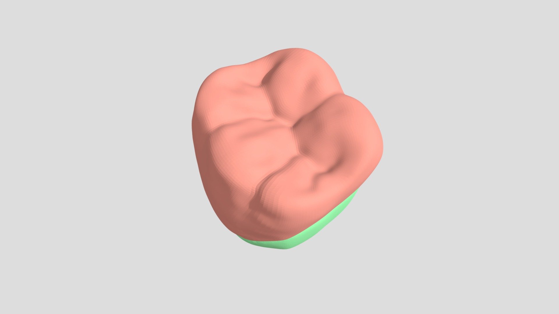Crown_prep_animated - 3D model by scobosc [7200524] - Sketchfab