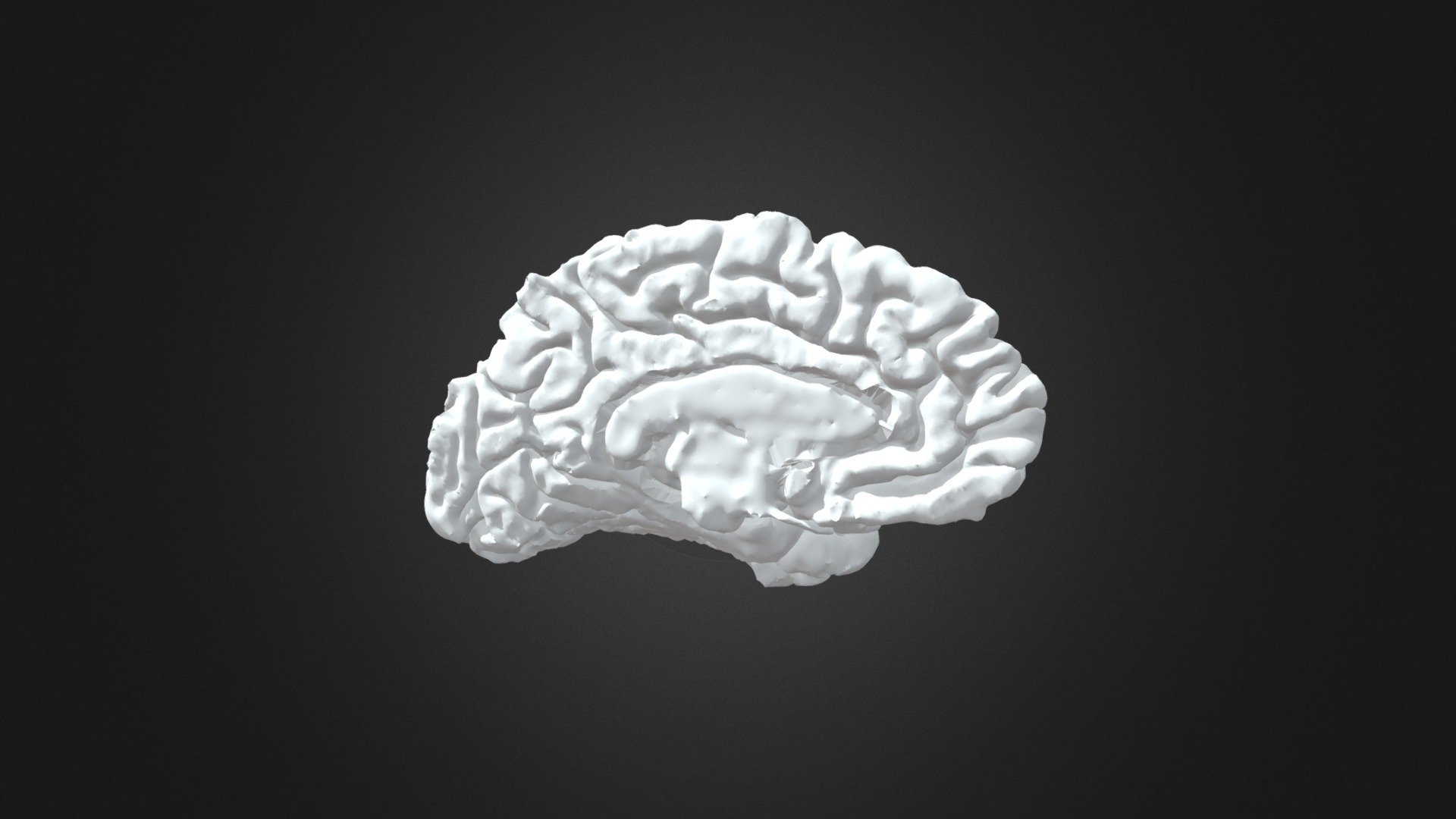 Brain Project: Neurotransmitter Production Areas - 3D model by alex ...
