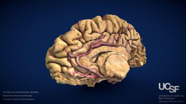 White-matter 3D models - Sketchfab