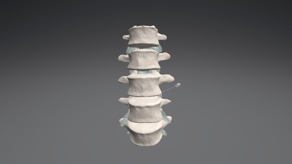 Lumbar Facet - 3D model by Justin Cramer (@jcramer) [7355b6d] - Sketchfab