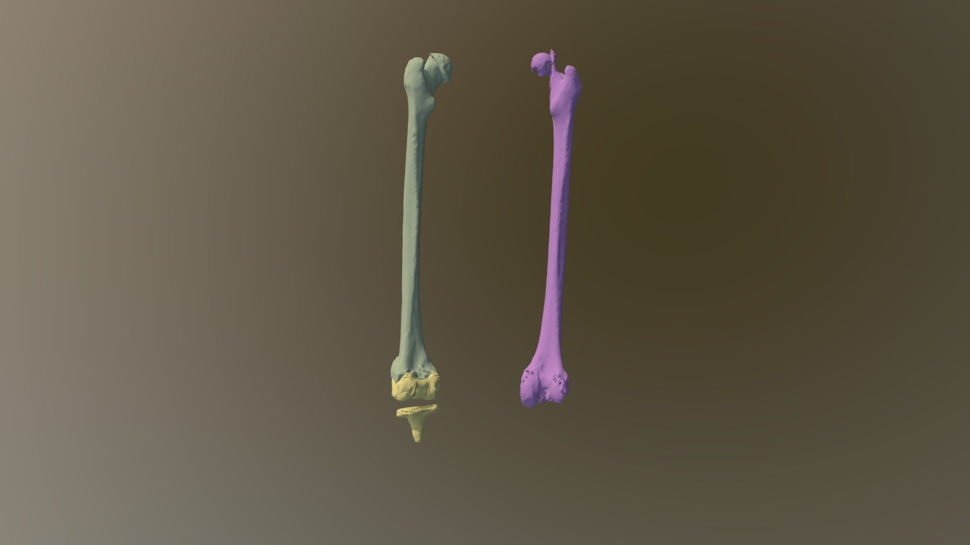 Colorful Femur Segmentation 3d Model By Lizmiller [73d6761] Sketchfab