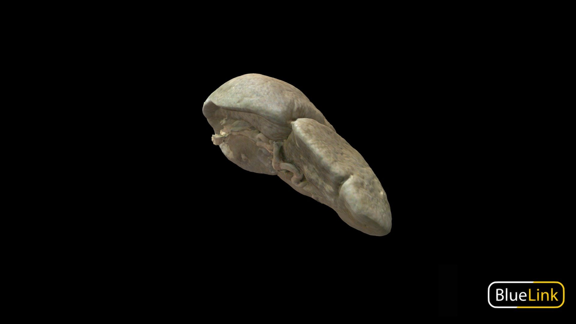 Spleen - 3D model by Bluelink Anatomy (@bluelinkanatomy) [73d98e4 ...