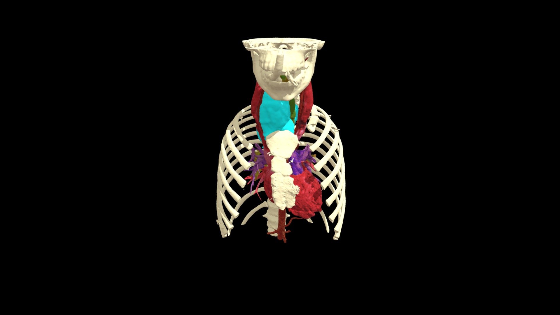 Tumor - 3D model by 3DCardio [74268dd] - Sketchfab