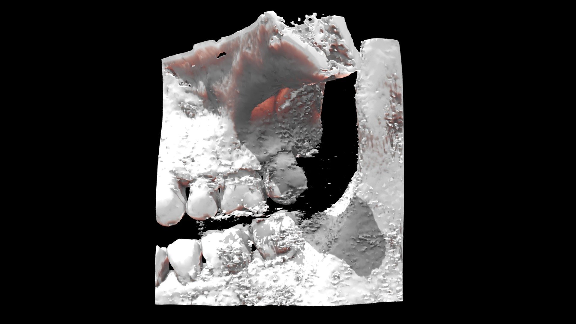 My Jaw and Teeth Scan - 3D model by Rhett Wimmer (@Pavus_The_Pug ...