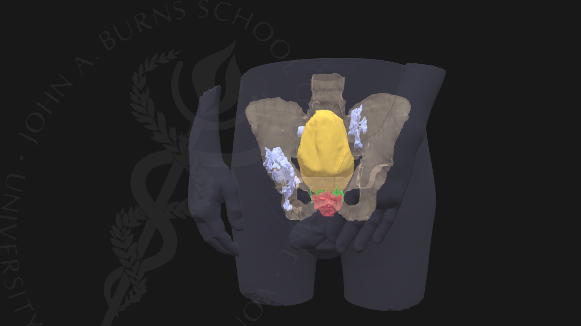 Prostate cancer model_2425 - 3D model by John A Burns School of ...