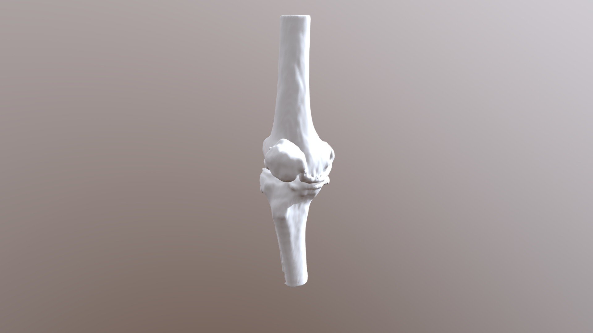 knee bone rt - 3D model by trivedi.jaimin [75296d2] - Sketchfab