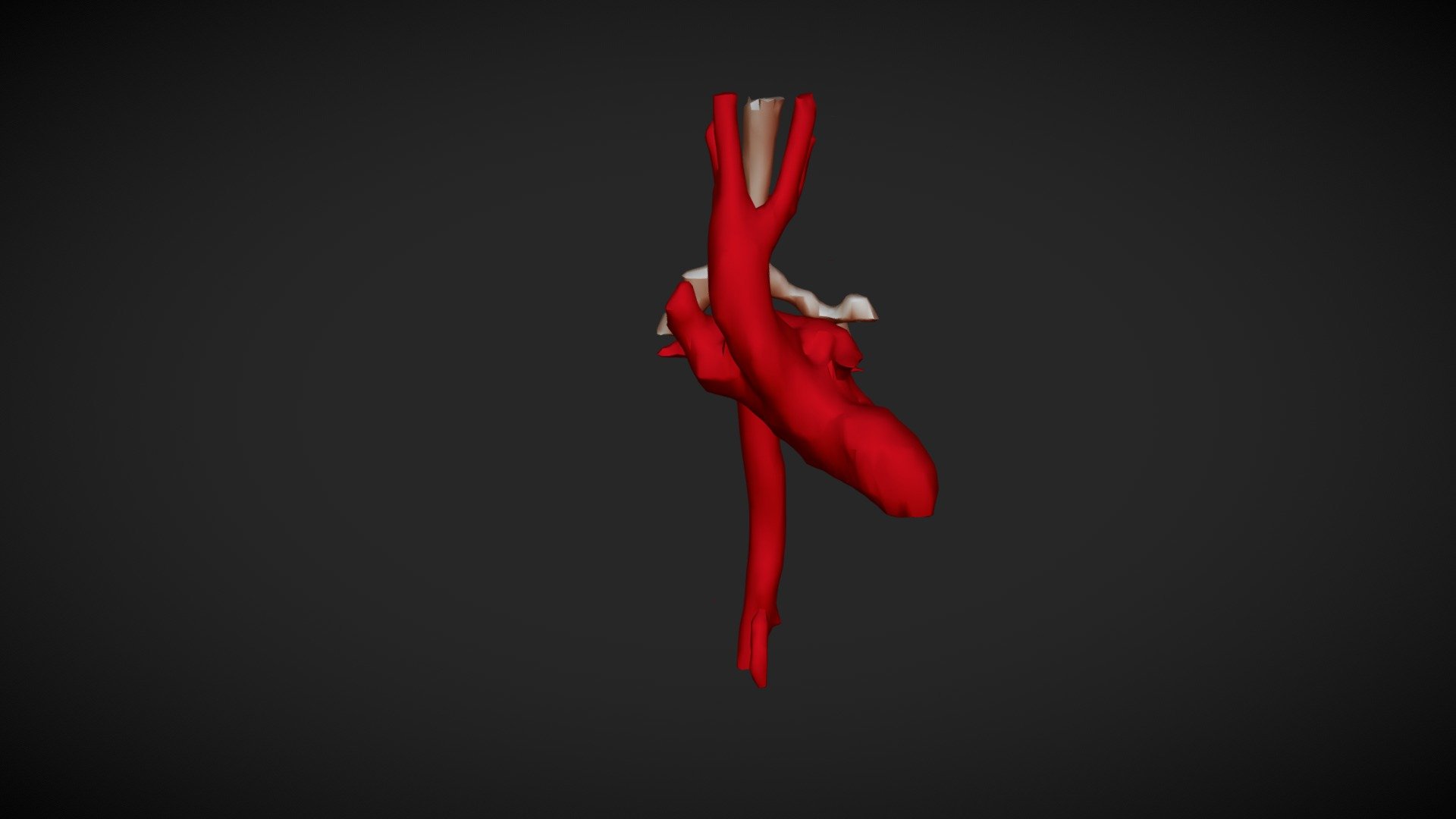 Double aortic arch and airway - Download Free 3D model by William ...