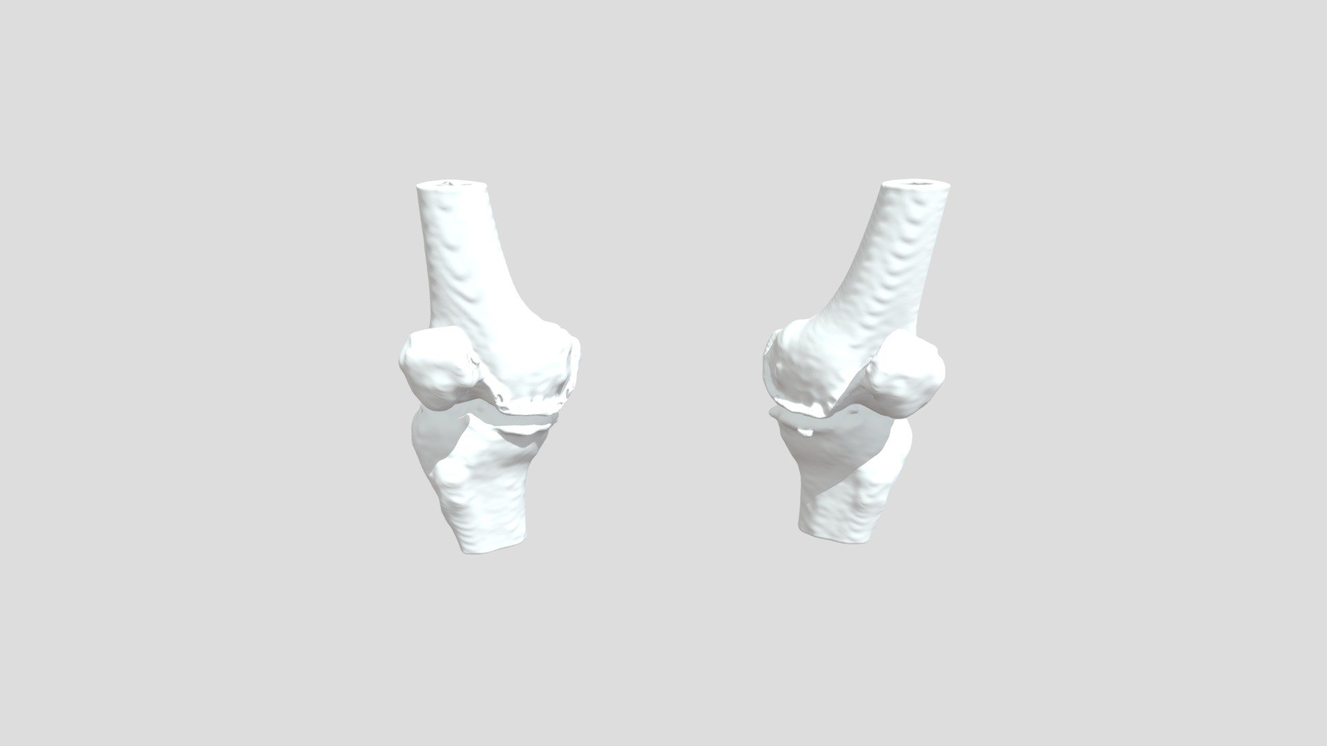Segmentation_ Segment_2 - 3D model by trivedi.jaimin [7593144] - Sketchfab