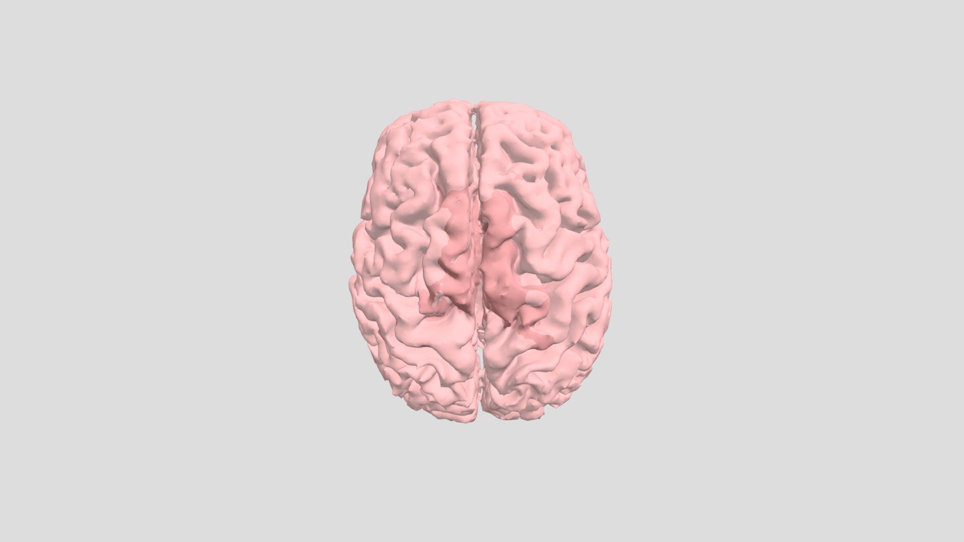 Parkinson's Pt Brain Segmentation - 3D model by jamiecronin [759583b ...