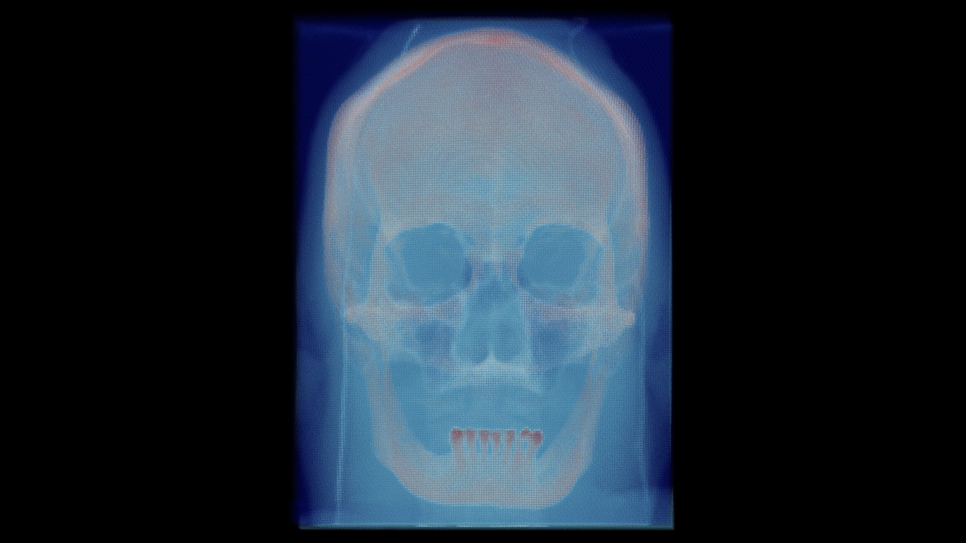Full CT Head Point Cloud--Visible Human Female - Download Free 3D model ...