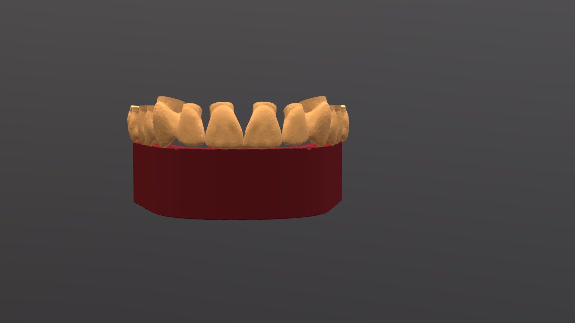 1_upper teeth on lower occ rim - 3D model by bsupanee [76430a4] - Sketchfab