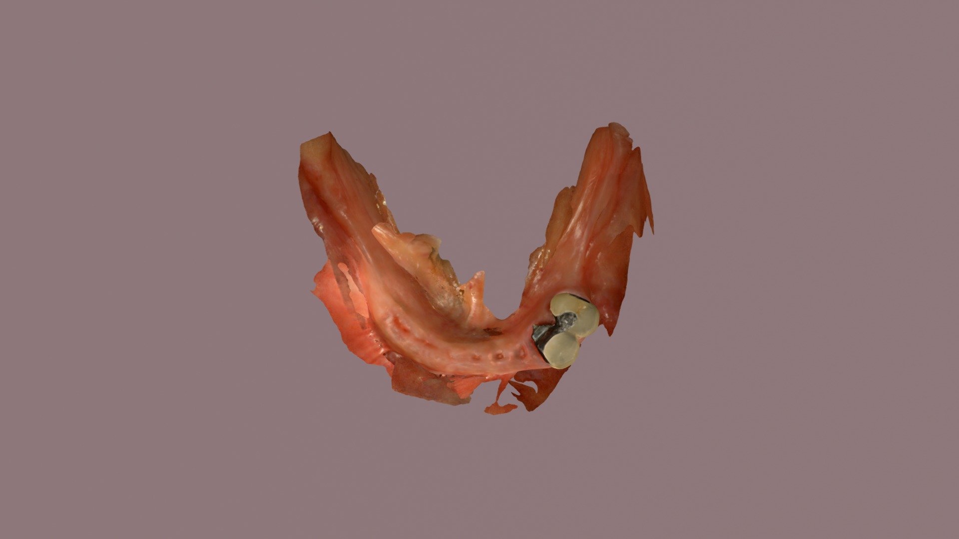 Mandibular digital impression - 3D model by jimarn [7652d44] - Sketchfab