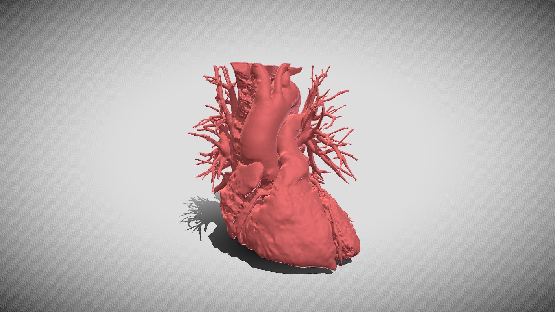 Contrast media flow model for teaching purposes - 3D model by tsrmadmin ...