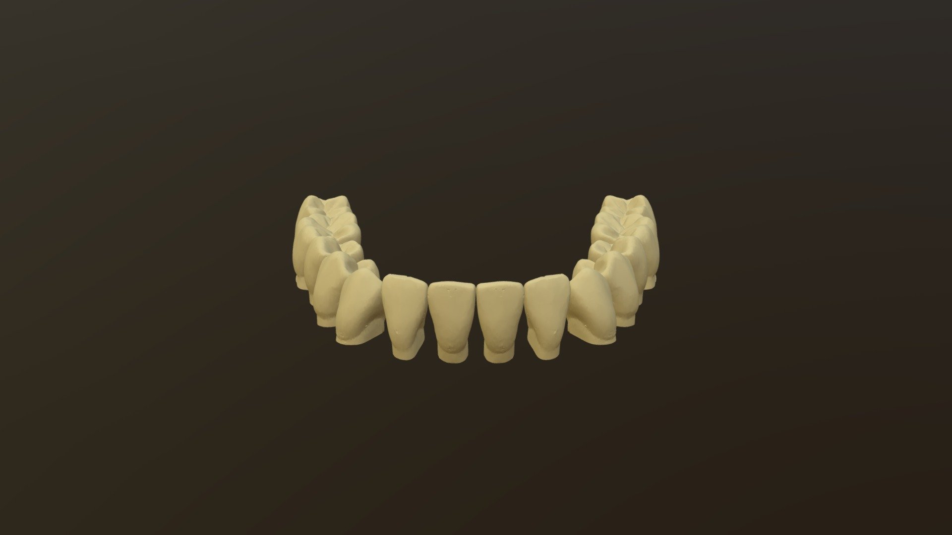4_lower teeth alignment - 3D model by bsupanee [77395b4] - Sketchfab