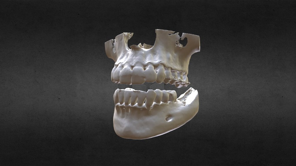 Full Jaw **Unedited - 3D model by Mission 3D (@mission3d) [774de65 ...