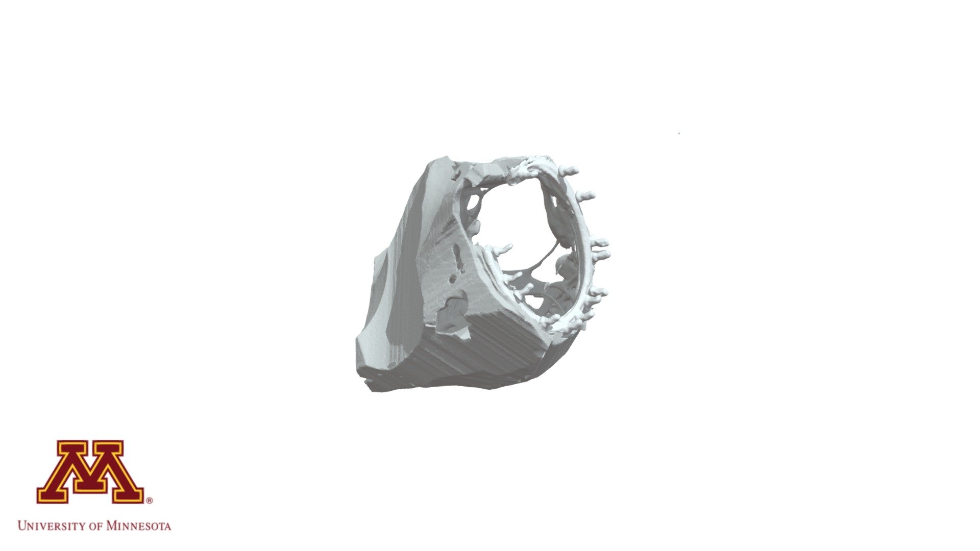 Tricuspid Valve With Annuloplasty Ring 3d Model By Visibleheartlabs 7776277 Sketchfab