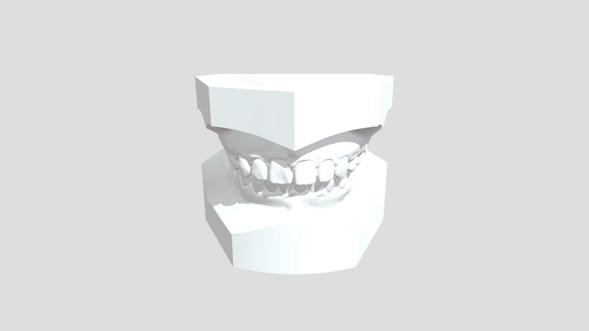 Case 5. Optional case B model JY Hwang - 3D model by orthogiant ...