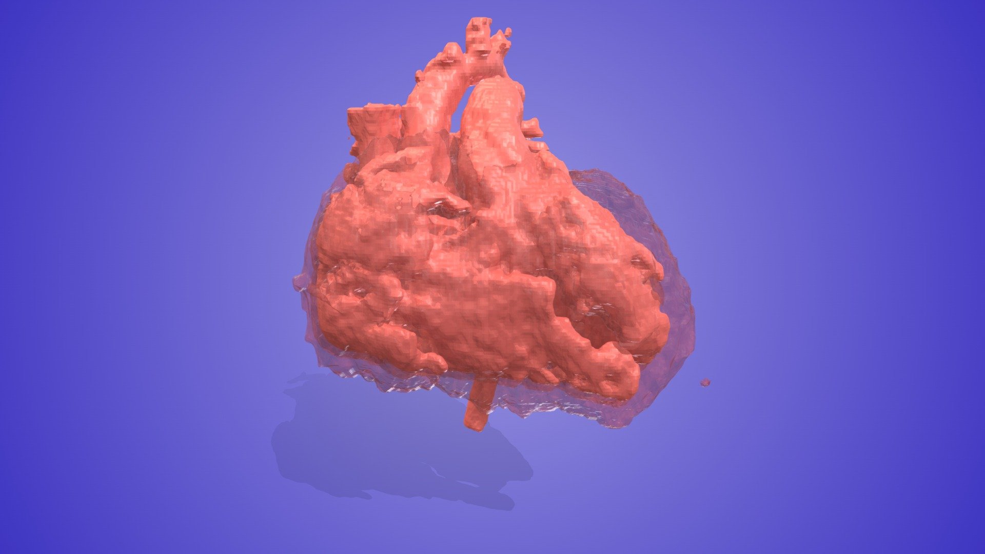 Normal Neonatal Heart - Download Free 3D model by 3D Heart Project ...