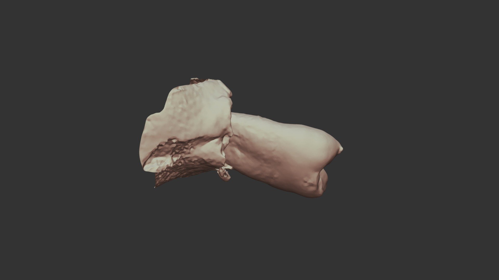 Tooth 13-group 10-scanner 6 Upper Jaw Upper Jaw - 3D model by UMdental ...