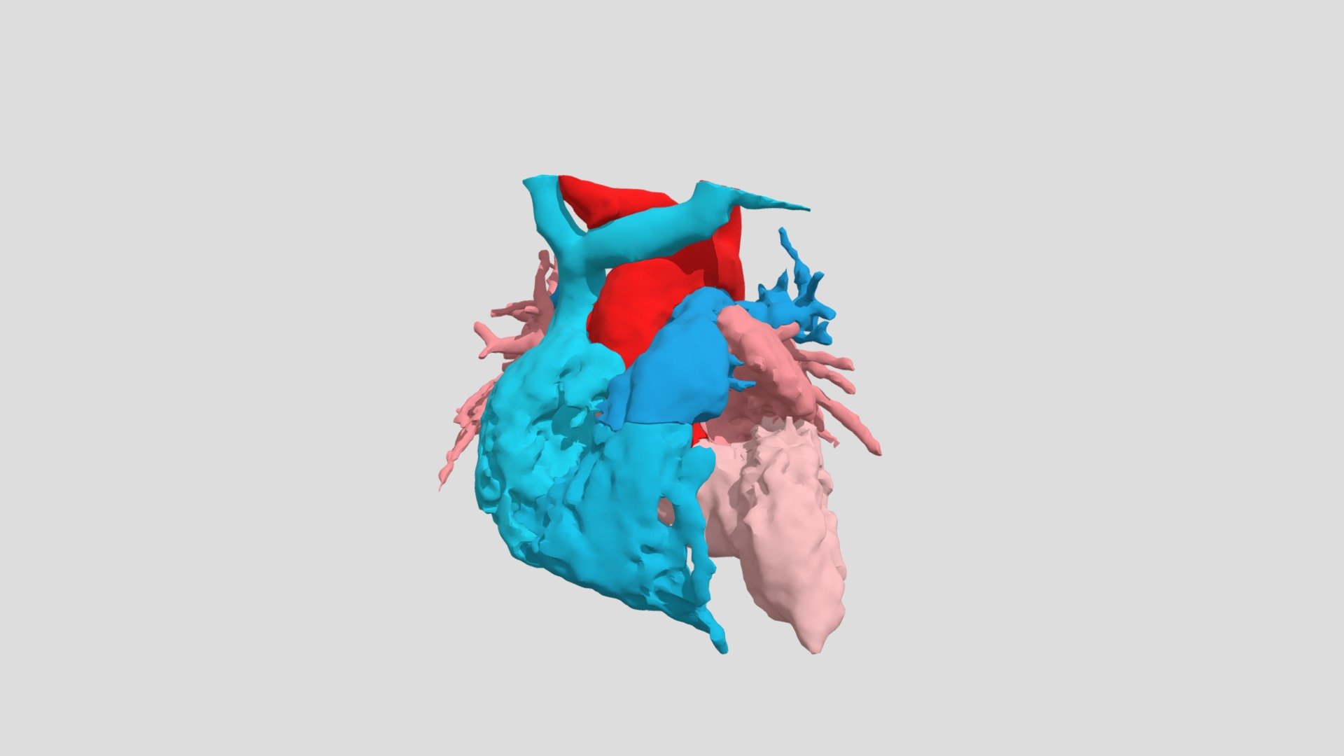 Hypertrophic Obstructive Cardiomyopathy (S0289) - 3D model by NCHS ...